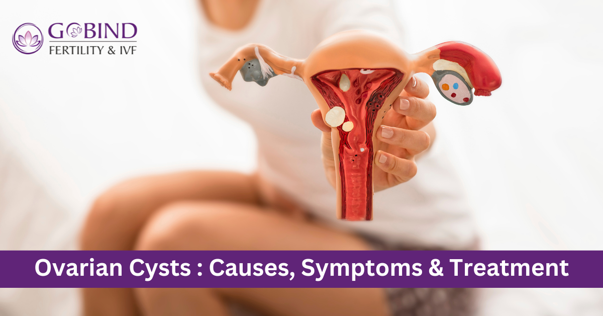 Ovarian Cyst: Causes, Symptoms, and Treatment - Gobind Fertility & IVF Centre
